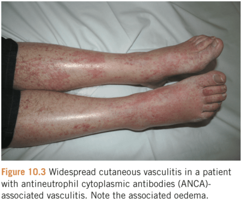 Part 3: Approach to the patient with complaints | Project Tulip Academy