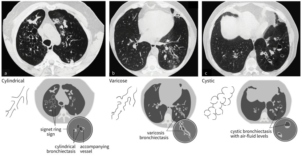 Part 2: Diseases | Project Tulip Academy